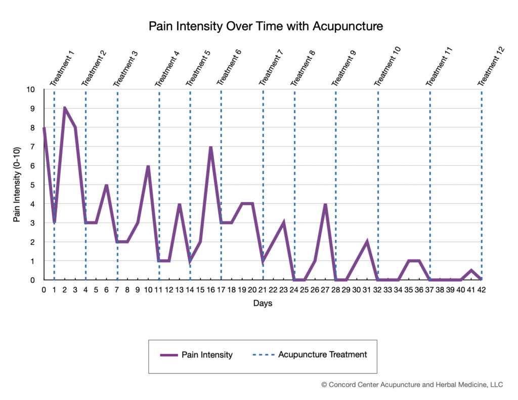 How Acupuncture Steps Down Pain – Concord Center Acupuncture and Herbal ...